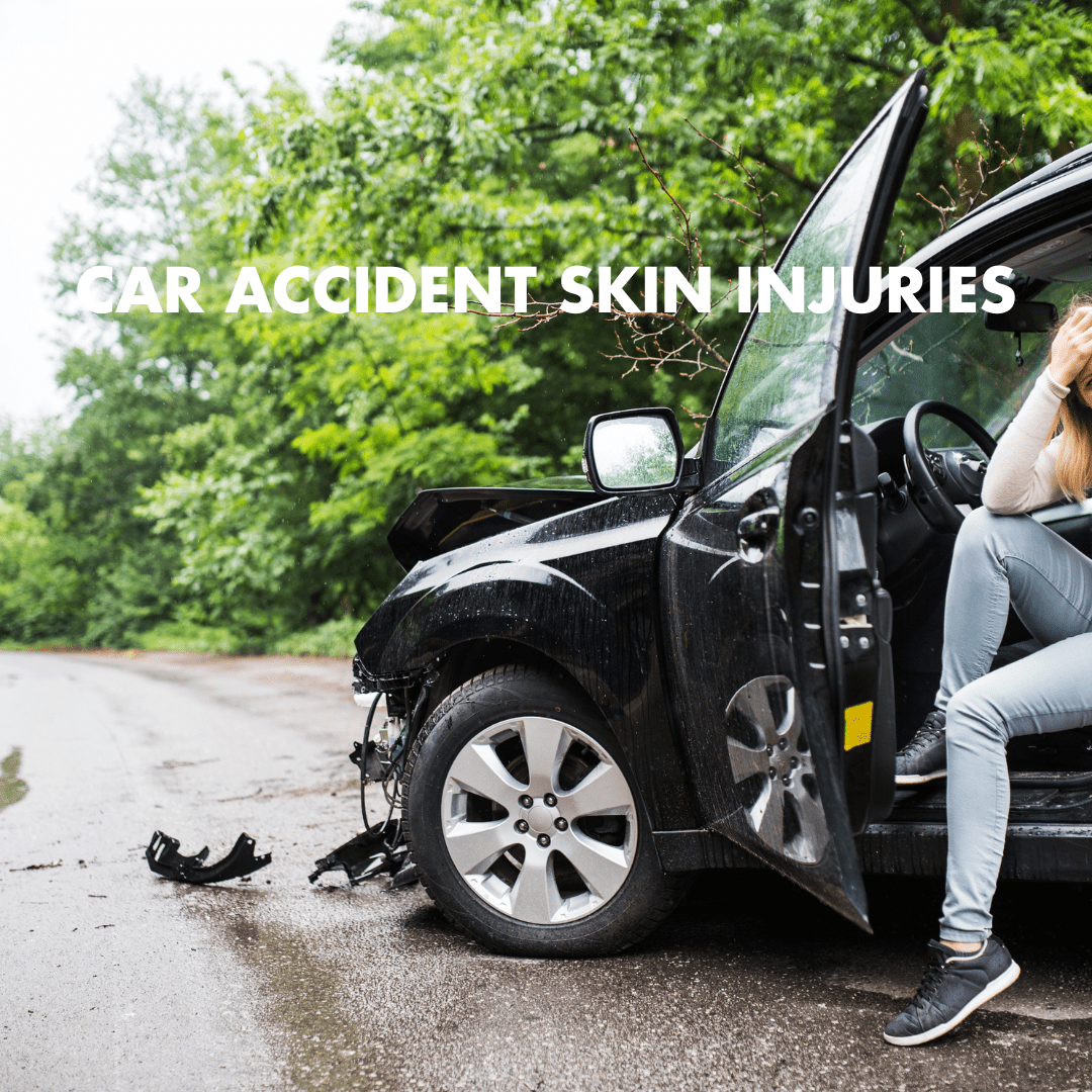 Car Accidents and Skin Injuries