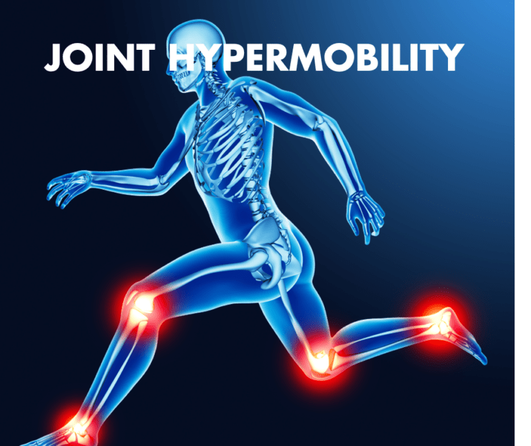 JOINT HYPERMOBILITY - Chambers Medical Group