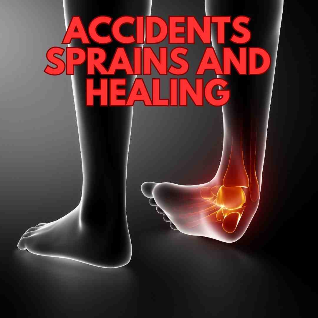 How Long does a Sprain Take to Heal?