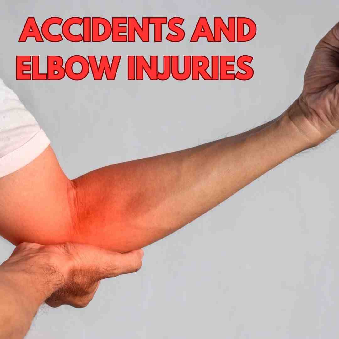 Car accidents and elbow injuries