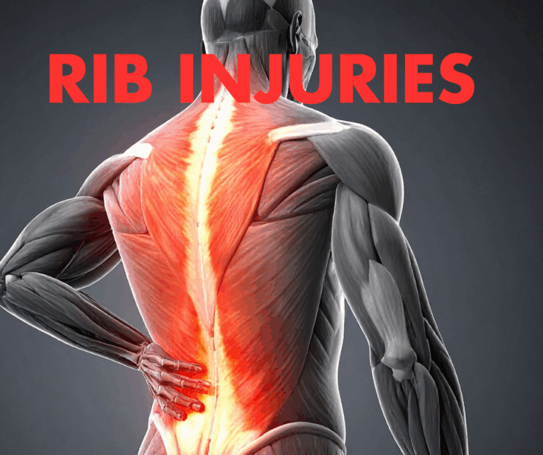 RIB INJURIES - Chambers Medical Group